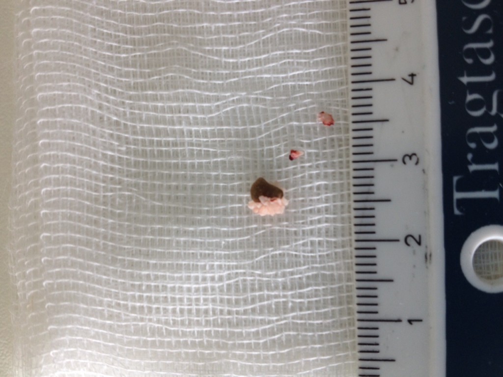 Blasensteine und Harngriess | Gross- und Kleintierpraxis Biglen